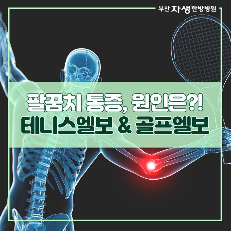 팔꿈치가 아파요 팔꿈치 통증 혹시 나도 테니스엘보and골프엘보 네이버 블로그