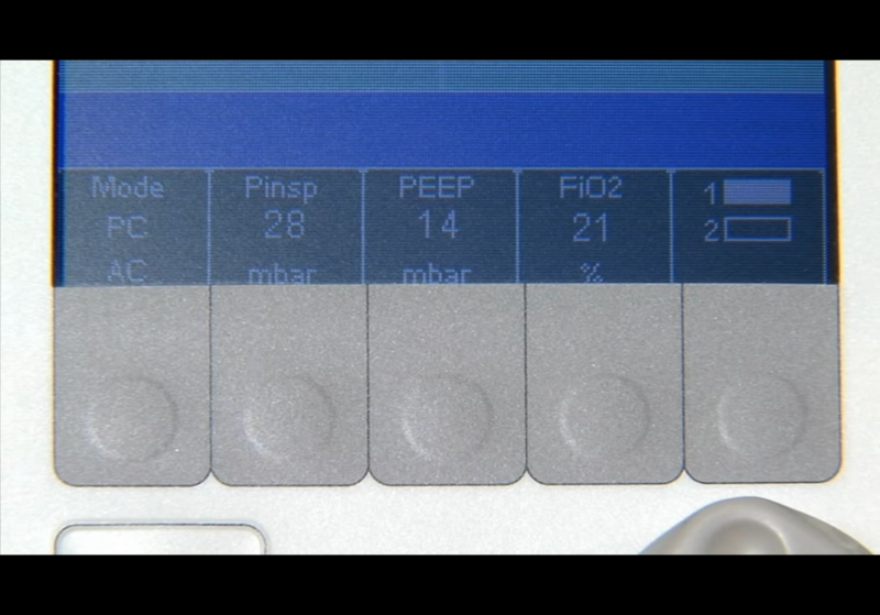 NIV) CPAP 와 BIPAP 비교하기 PEEP, IPAP, EPAP 공부하기 : 네이버 블로그