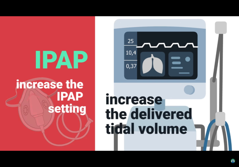 NIV) CPAP 와 BIPAP 비교하기 PEEP, IPAP, EPAP 공부하기 : 네이버 블로그