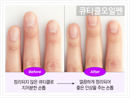 올리브영 큐티클 오일펜 추천템 모음 큐티클 제거방법 정리 네이버 블로그