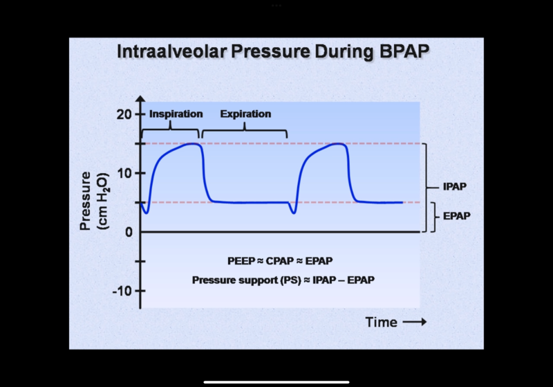 NIV) CPAP 와 BIPAP 비교하기 PEEP, IPAP, EPAP 공부하기 : 네이버 블로그