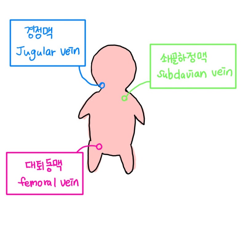 C Line Central Venous Catheter 중심정맥관 삽입 위치 Jugularsubclavianfemoral
