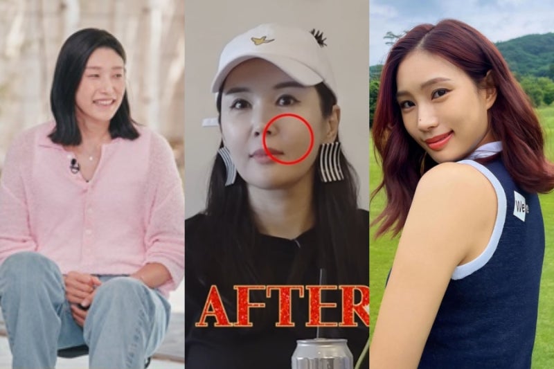 김연경 유퀴즈·장영란 팔자주름·유현주 근황｜스타 핫이슈 : 네이버 블로그