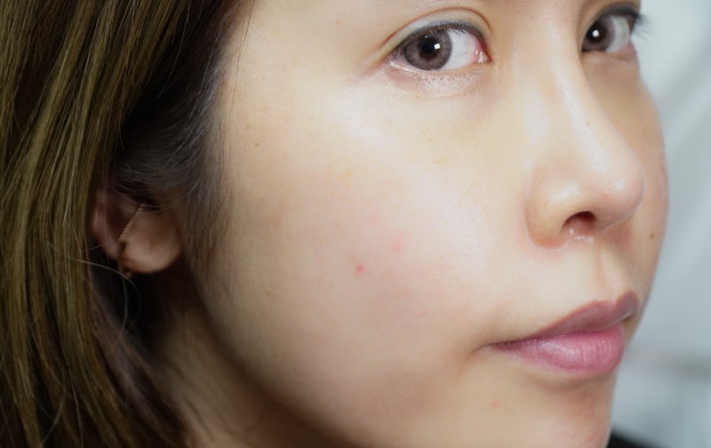 얼굴탄력 고민 이보영 미용기기 마데카프라임 사용해보니 네이버 블로그