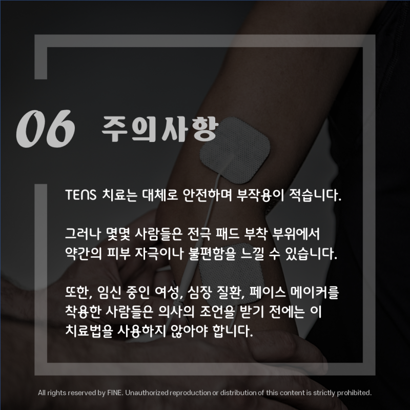 경피적전기신경자극치료 Tens 저주파치료 란 Feat 대한밸런스의학회 네이버 블로그