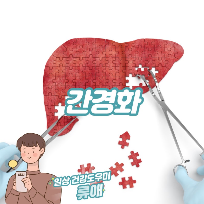 간경화 초기증상 및 원인 치료 알콜성 간경화 말기증상 통증 음식 네이버 블로그