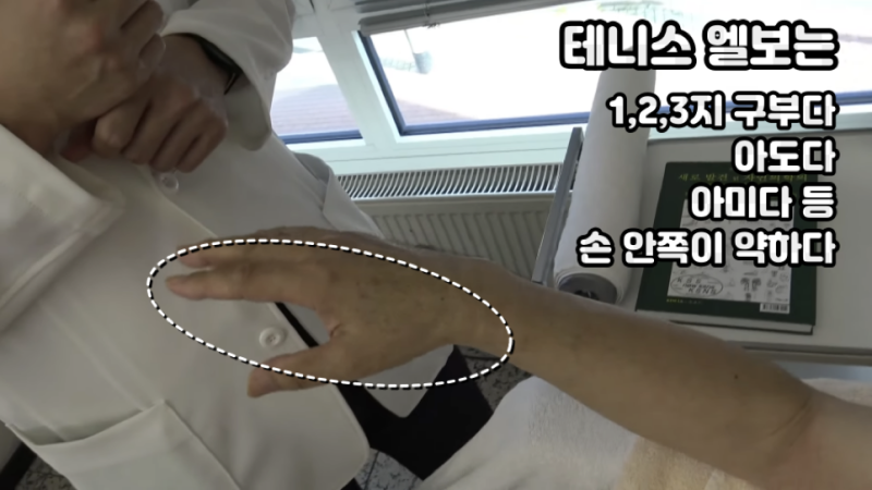 354. 테니스 엘보 KSNS KSS 스본 스도로 완치된다 : 네이버 블로그