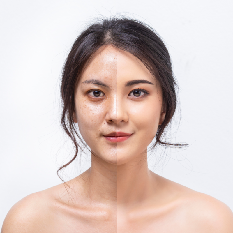 화이트태닝 가격 얼굴 로션 기계 주기 원리 실제로 효과 있을까 네이버 블로그