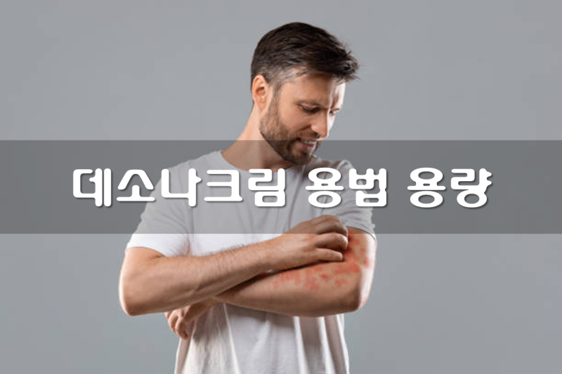 데소나크림 005 염증 가려움증 스테로이드 데소나 효능 용법 부작용 주의사항 가격 네이버 블로그