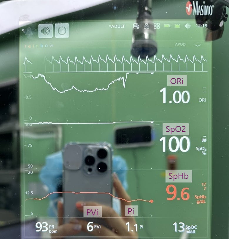 Masimo rainbow set는 무엇인가요? - SpHb, PVi, ORi, Pi, SpMet : 네이버 블로그