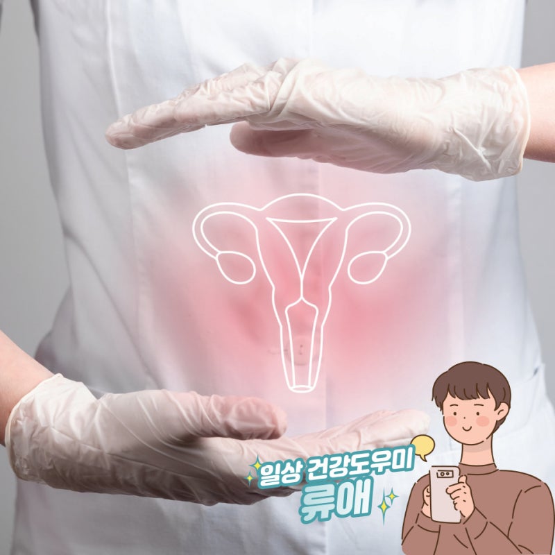 자궁근종 증상 및 통증 치료수술 폐경기 자궁근종 물혹 크기 네이버 블로그
