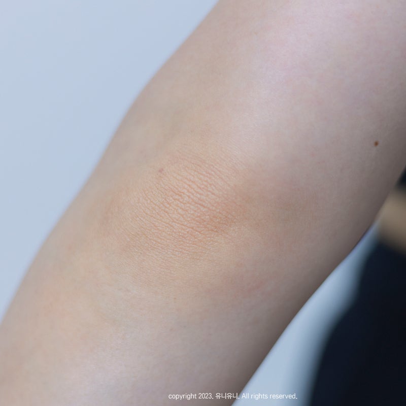 팔꿈치 착색 해결하는 겟잇뷰티 바디미백크림 블랙샷사타구니 겨드랑이 피부 색소침착 네이버 블로그