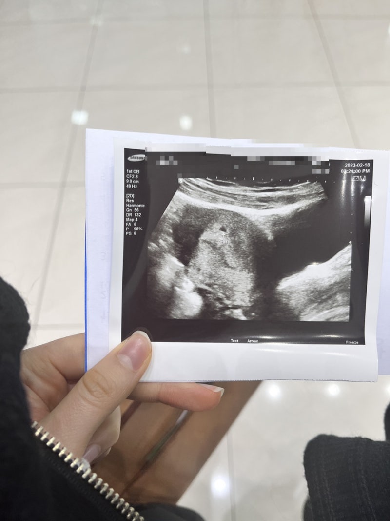 임신 5주 임신 극초기증상 임신 초기 알아두면 좋은 것들 네이버 블로그