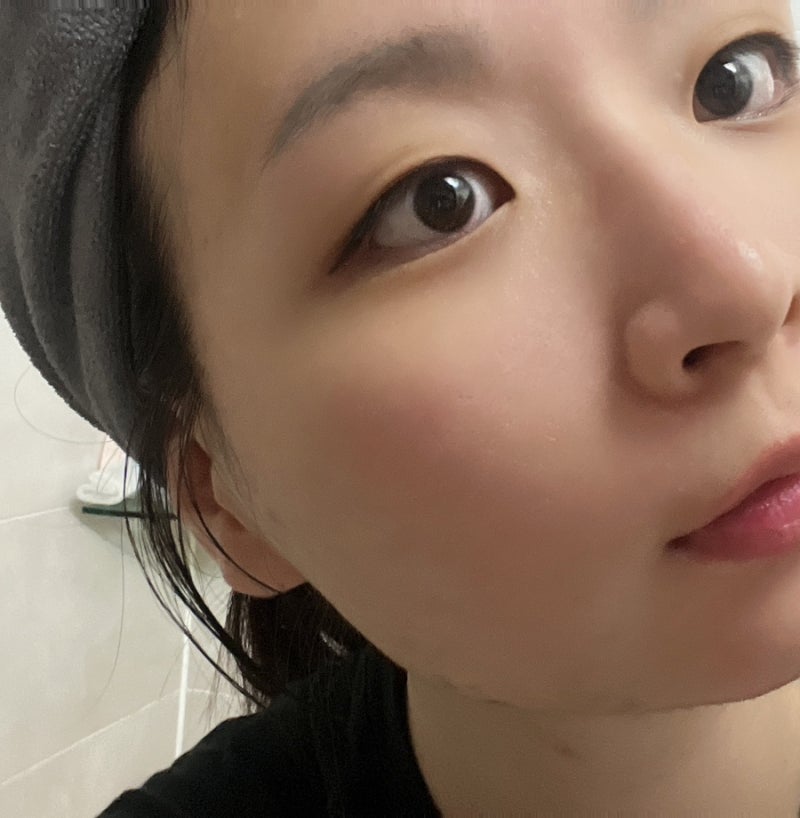 여드름클렌징폼 추천 에이씨 솔루션 클래라파잉 폼클렌저 찐 사용후기 네이버 블로그