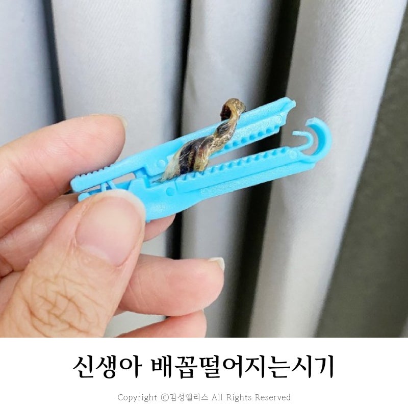 신생아 탯줄 배꼽 떨어지는시기 신생아 제대탈락 배꼽피 소독 관리방법 네이버 블로그