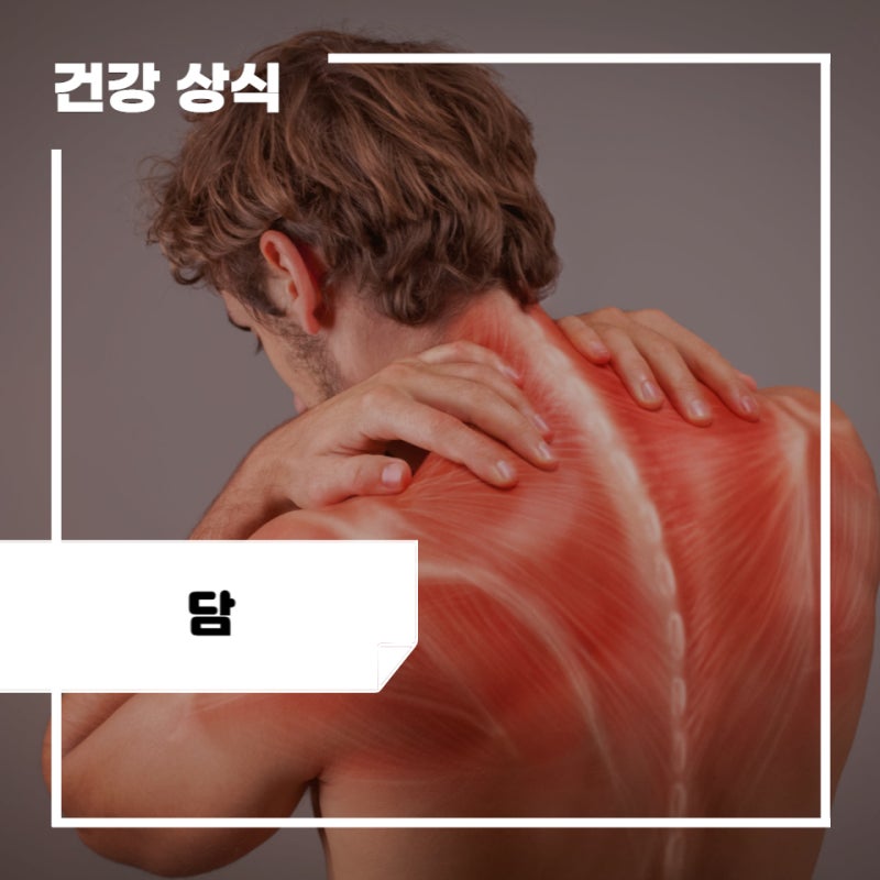 담 걸리는 이유와 증상 및 담 걸렸을때 빠르게 푸는법스트레칭 약 병원 진료과 목 어깨 허리 등에 담 네이버 블로그