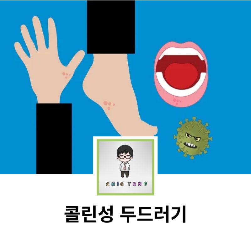 콜린성 두드러기 약 치료 스테로이드 연고 네이버 블로그
