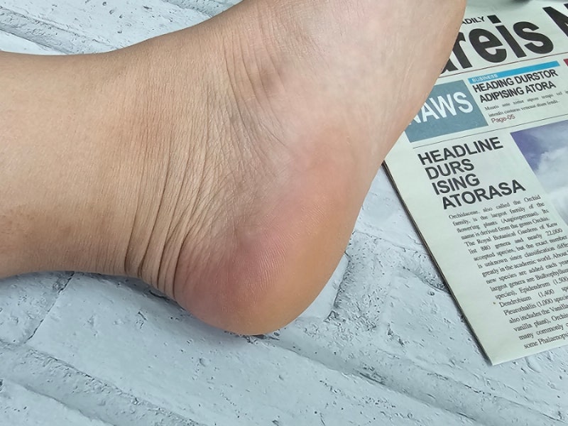전동 발각질제거기 굳은살 제거하기 쉬운 오스메틱 패디힐 네이버 블로그