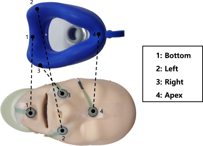 Intubation 전 단계 환자의 갑작스러운 SpO2 저하 : MR SOPA(Ventilative Corrective step ...
