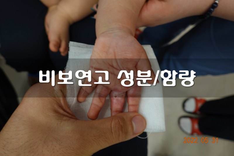미보연고 화상 상처 세균감염 흉터 연고 미보 효능 용법 부작용 주의사항 가격 네이버 블로그