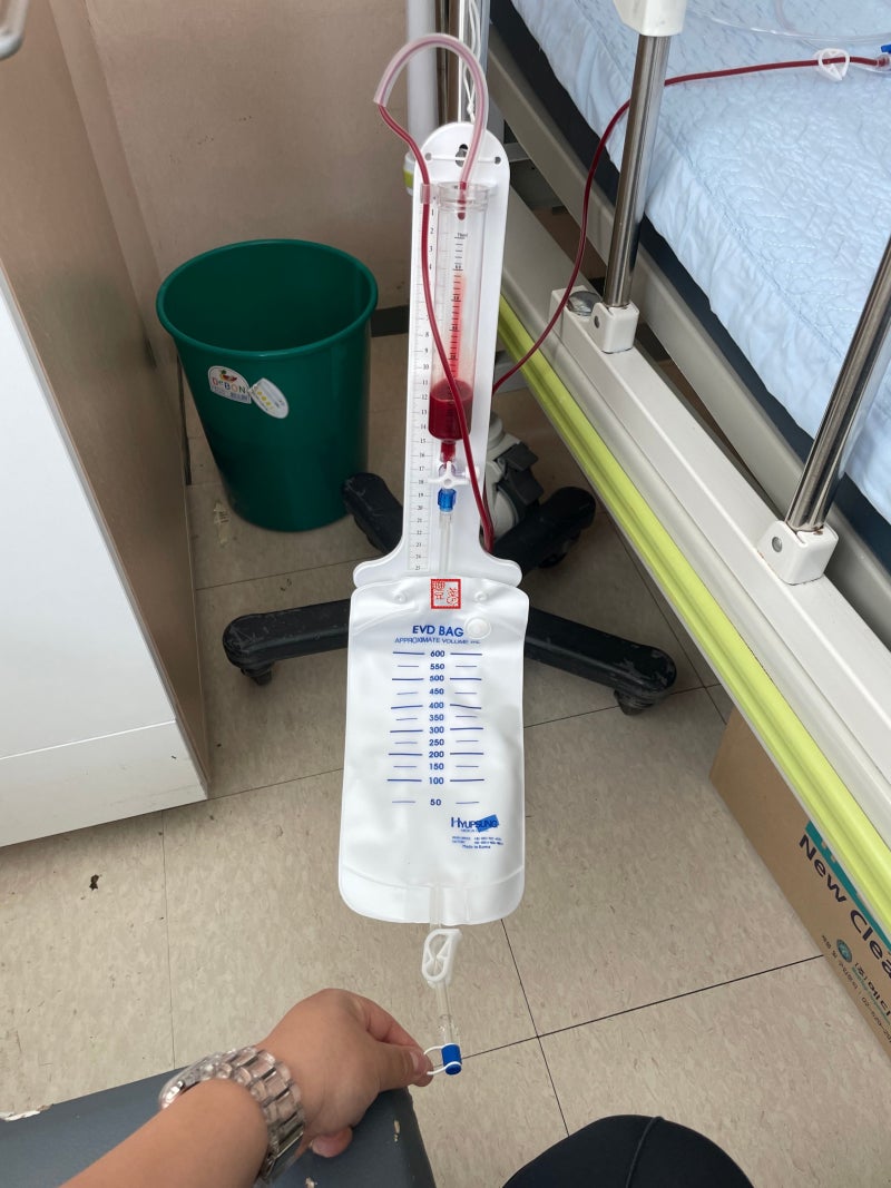 [ NS, 신경외과 ] EVD(Extra- Ventricular Draunage) 관리, 뇌실외 배액 / EVD 정의, 적응증 ...