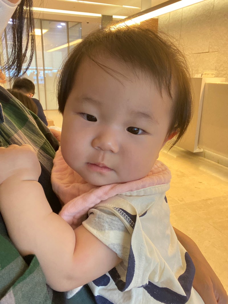 9개월 아기 이소성 몽고반점 선천성 모반 4차 후기 네이버 블로그