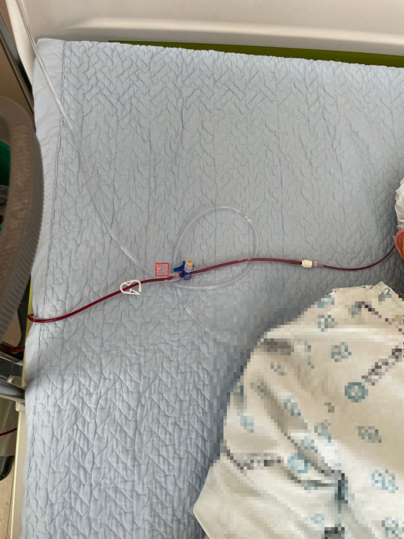 [ NS, 신경외과 ] EVD(Extra- Ventricular Draunage) 관리, 뇌실외 배액 / EVD 정의, 적응증 ...