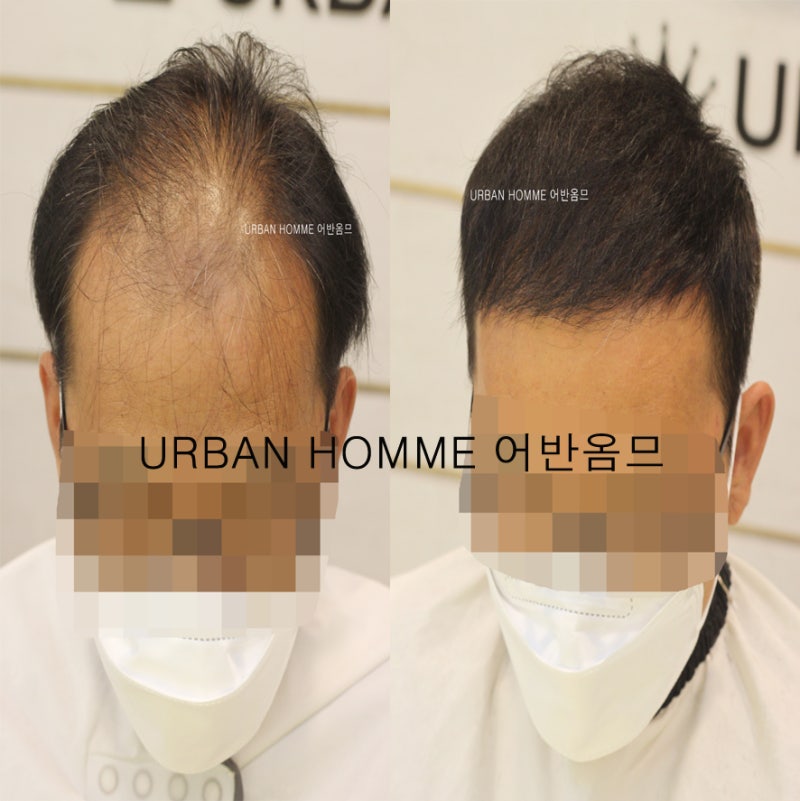 탈모 파마 머리숱 없는 남자 헤어스타일 40대 50대 단점 커버 했어요 네이버 블로그