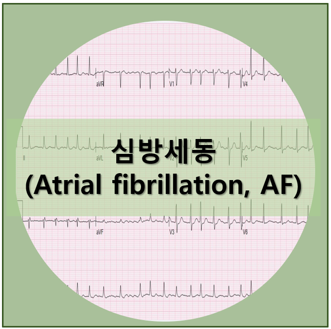 심방세동 총정리 atrial fibrillation, 의학용어 AF, Afib, Paroxysmal, Persistent 정의 ...
