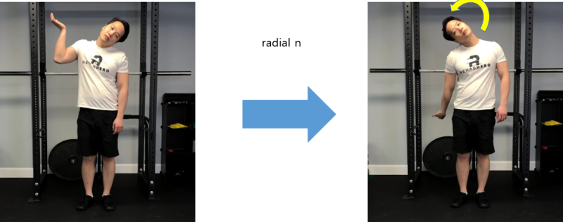 ULTT(upper limb tension test)와 nerve flossing(신경가동술)에 대해 : 네이버 블로그
