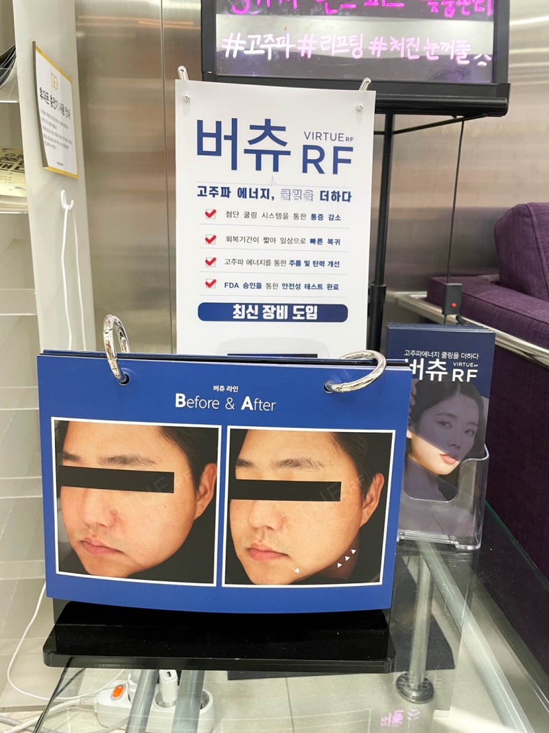 여의도역 피부과 버츄rf 효과 7일차 리얼후기 네이버 블로그