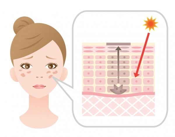 약국 도미나크림 Vs 멜라논크림 차이 사용법 부작용 가격 효과 비교 히드로퀴논 내돈내산 네이버 블로그