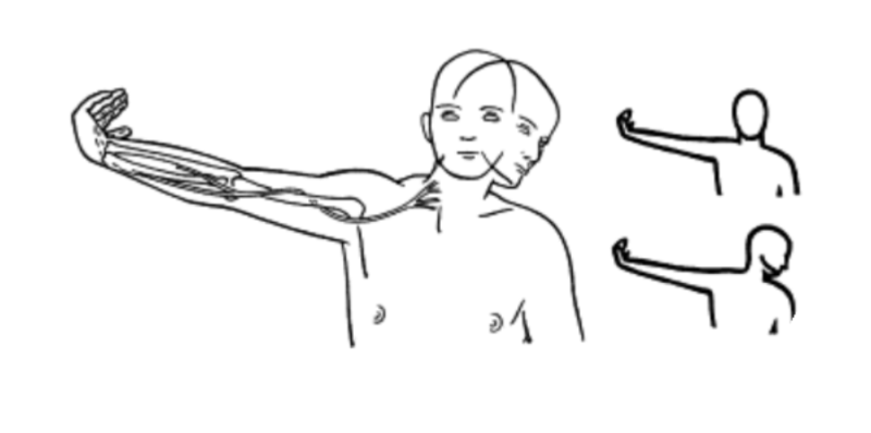 ULTT(upper limb tension test)와 nerve flossing(신경가동술)에 대해 : 네이버 블로그