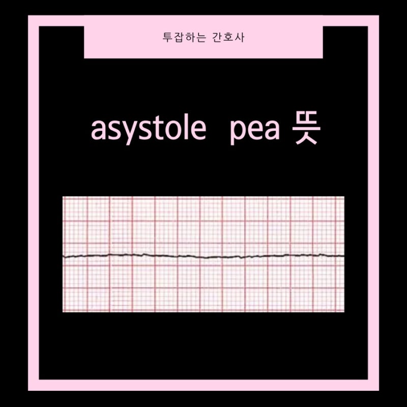 Asystole , PEA , TTM 의학용어 알아볼게요. : 네이버 블로그