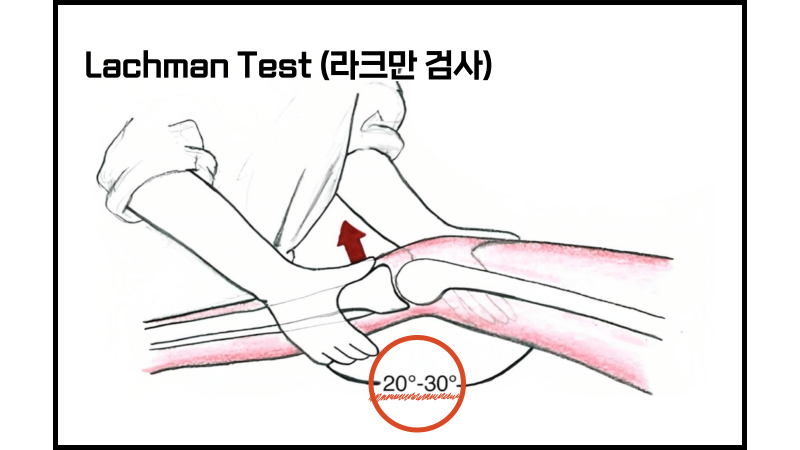Lachman Test(라크만 검사) / 전방십자인대 손상 검사,안정성 검사, 파열 검사 /무릎 이학적 검사, special ...