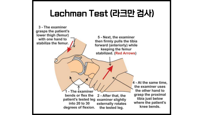 Lachman Test(라크만 검사) / 전방십자인대 손상 검사,안정성 검사, 파열 검사 /무릎 이학적 검사, special ...