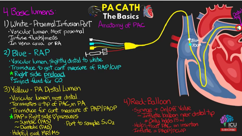 Hemodynamic monitoring by Swan Ganz catheter : 네이버 블로그