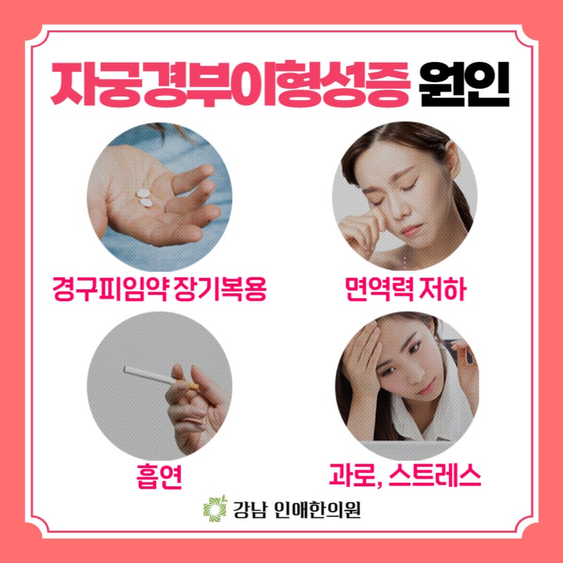 자궁경부이형성증 원인 증상 비교 단계별 치료 방법 네이버 블로그
