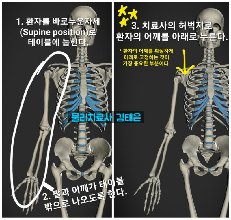 팔이 저려요 - 요골신경 포착(Radial nerve entrapment) - ULTT(Upper limb tension ...