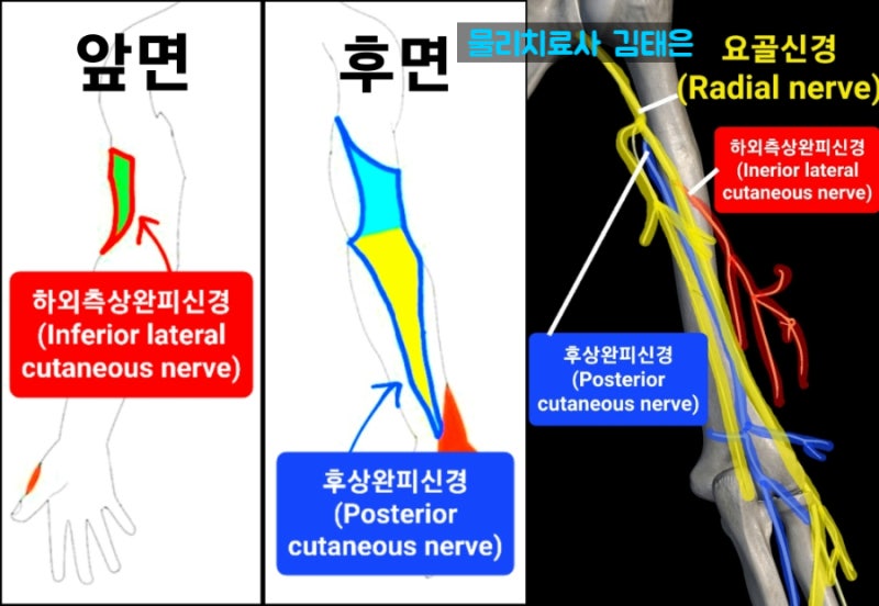 팔이 저려요 요골신경 포착radial Nerve Entrapment Ulttupper Limb Tension