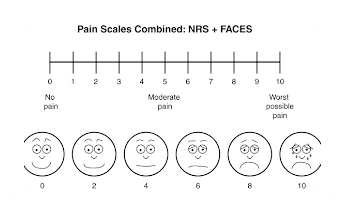 통증척도평가 통증사정 VAS, VRS, NRS, FPRS(얼굴통증척도) : 네이버 블로그