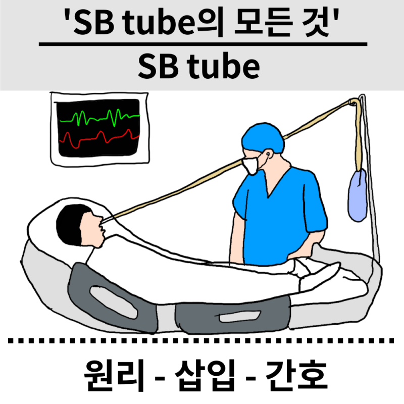 SB tube(Sengstaken - blakemore tube)의 모든 것 : 네이버 블로그