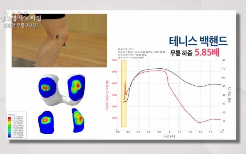 무릎관절에 나쁜 자세 운동 ️무릎하중 응력 쪼그려앉기는 무릎에 치명적 네이버 블로그