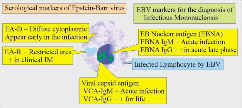 전염성단핵구증, EBV (Ebstein-Barr virus) 항체검사 : 네이버 블로그