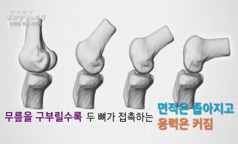 무릎관절에 나쁜 자세 운동 ️무릎하중 응력 쪼그려앉기는 무릎에 치명적 네이버 블로그