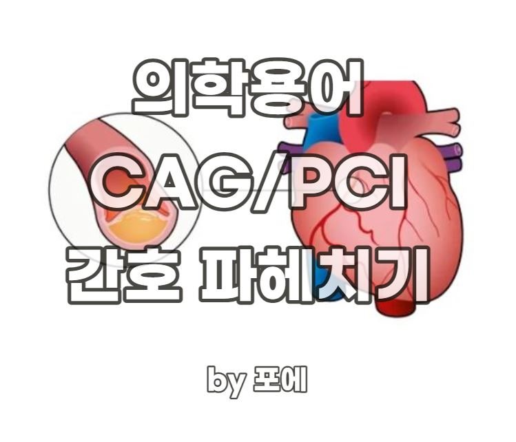의학용어 Cag Pci 관상동맥조영술 경피적관상동맥중재술 목적시술 과정 시술 전후 간호 네이버 블로그