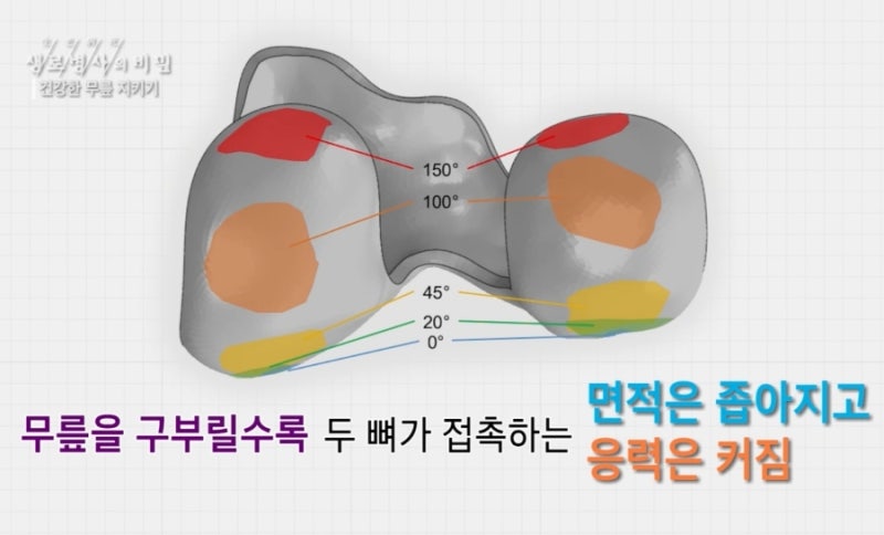 무릎관절에 나쁜 자세 운동 ️무릎하중 응력 쪼그려앉기는 무릎에 치명적 네이버 블로그