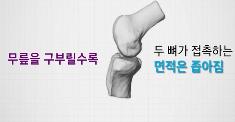 무릎관절에 나쁜 자세 운동 ️무릎하중 응력 쪼그려앉기는 무릎에 치명적 네이버 블로그