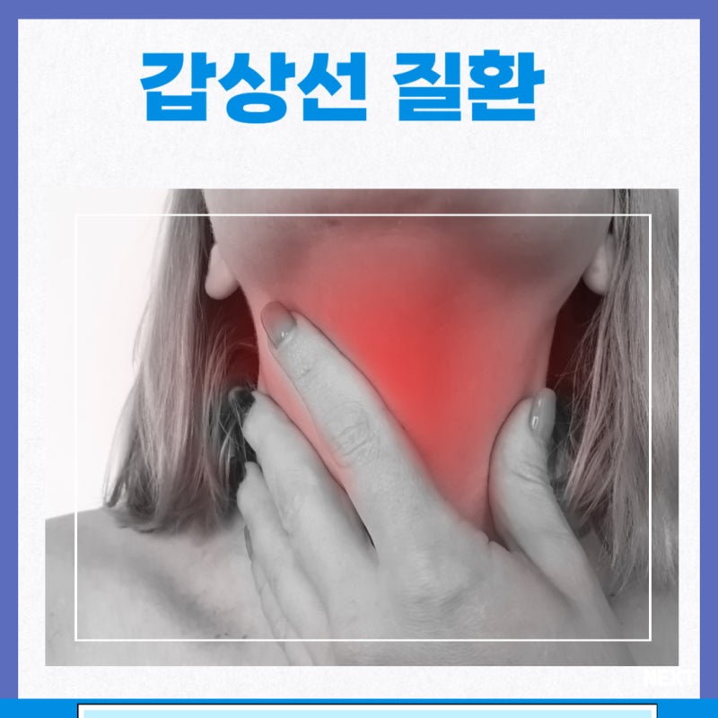 갑상선 검사 질환 갑상선 결절 하시모토 갑상선염 그레이브스병 네이버 블로그