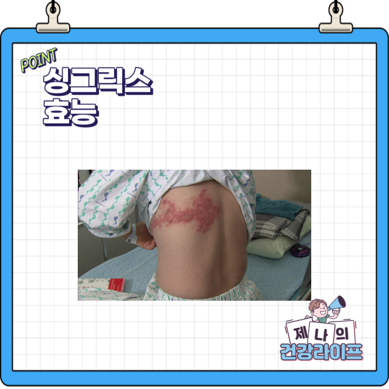 대상포진 예방접종 싱그릭스 가격과 부작용 접종 간격 횟수 네이버 블로그